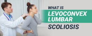 What is Levoconvex Lumbar Scoliosis?