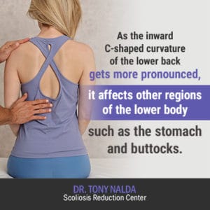 Hyperlordosis: What It Is, Symptoms, and Treatment