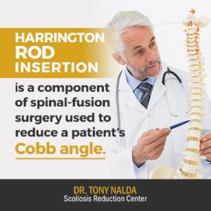 Harrington Rod for Scoliosis: Surgery, Issues, and More