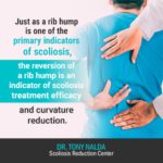 Rib Hump and Scoliosis: Causes, Pain, Treatment & More