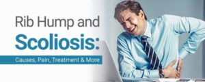 Rib Hump and Scoliosis: Causes, Pain, Treatment & More