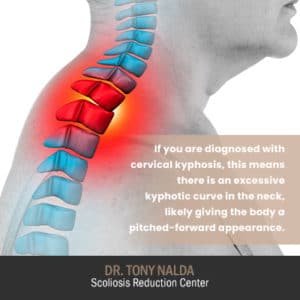 Cervical Kyphosis: What Is The Best Treatment For Kyphosis?