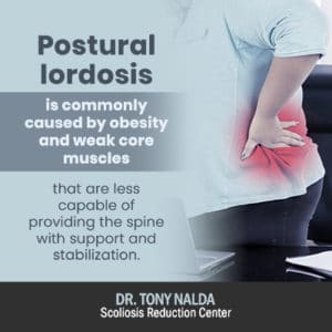 Thoracic Lordosis: What Is Lordosis? Treatment Options