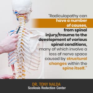 What Is Radiculopathy? Cervical, Lumbar, and Thoracic Types