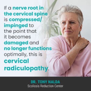 Cervical Radiculopathy Treatment: What You Need To Know