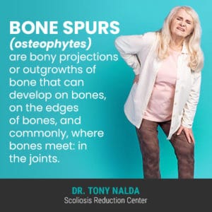 Bone Spurs On Spine: What Is The Treatment?