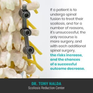 Scoliosis Surgery Success Rate & Scoliosis Surgery Alternatives