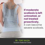 When Is Scoliosis Bad? When To Seek Scoliosis Treatment?