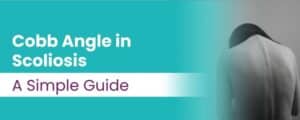 Cobb Angle in Scoliosis: A Simple Guide